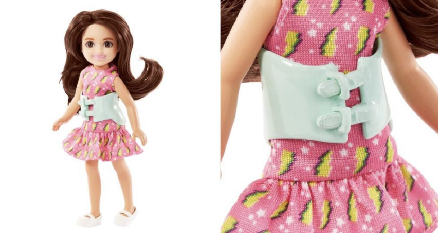 Mattel Releases First Ever Doll With Scoliosis